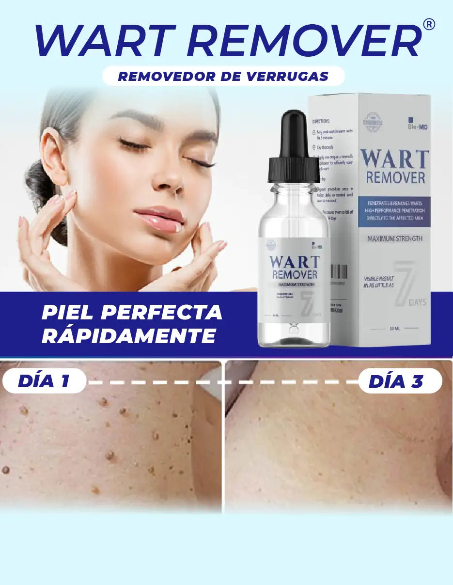 REMOVEDOR DE VERRUGAS WART REMOVER [PV1-TIKTOK-HYPEIMPORTS] – Hypeimports